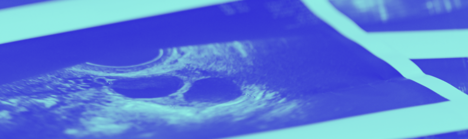 The truth about “mini IVF” and egg freezing